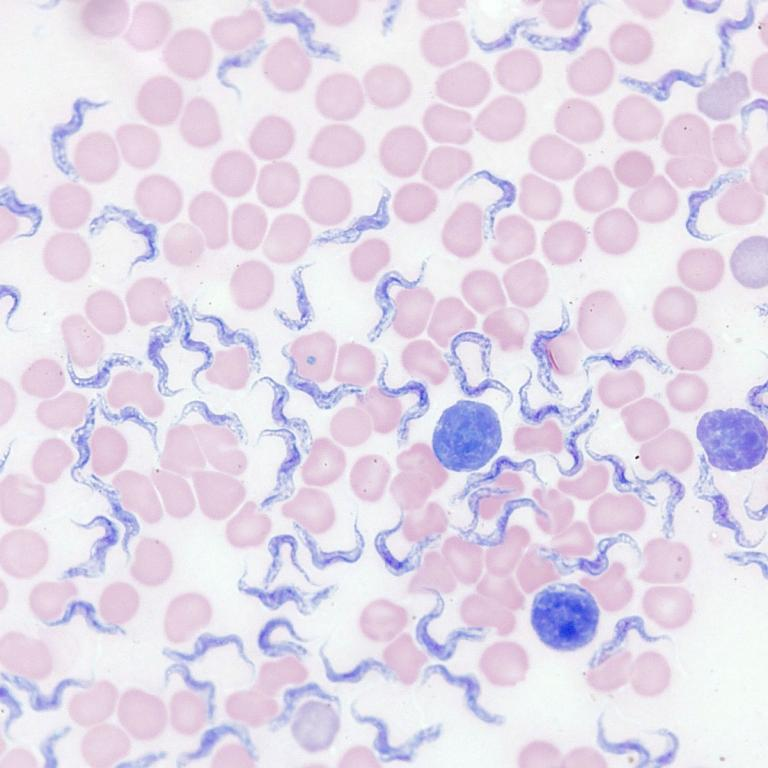 Hematology Bundle Download